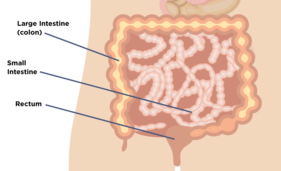 Crohns Disease Guts Uk