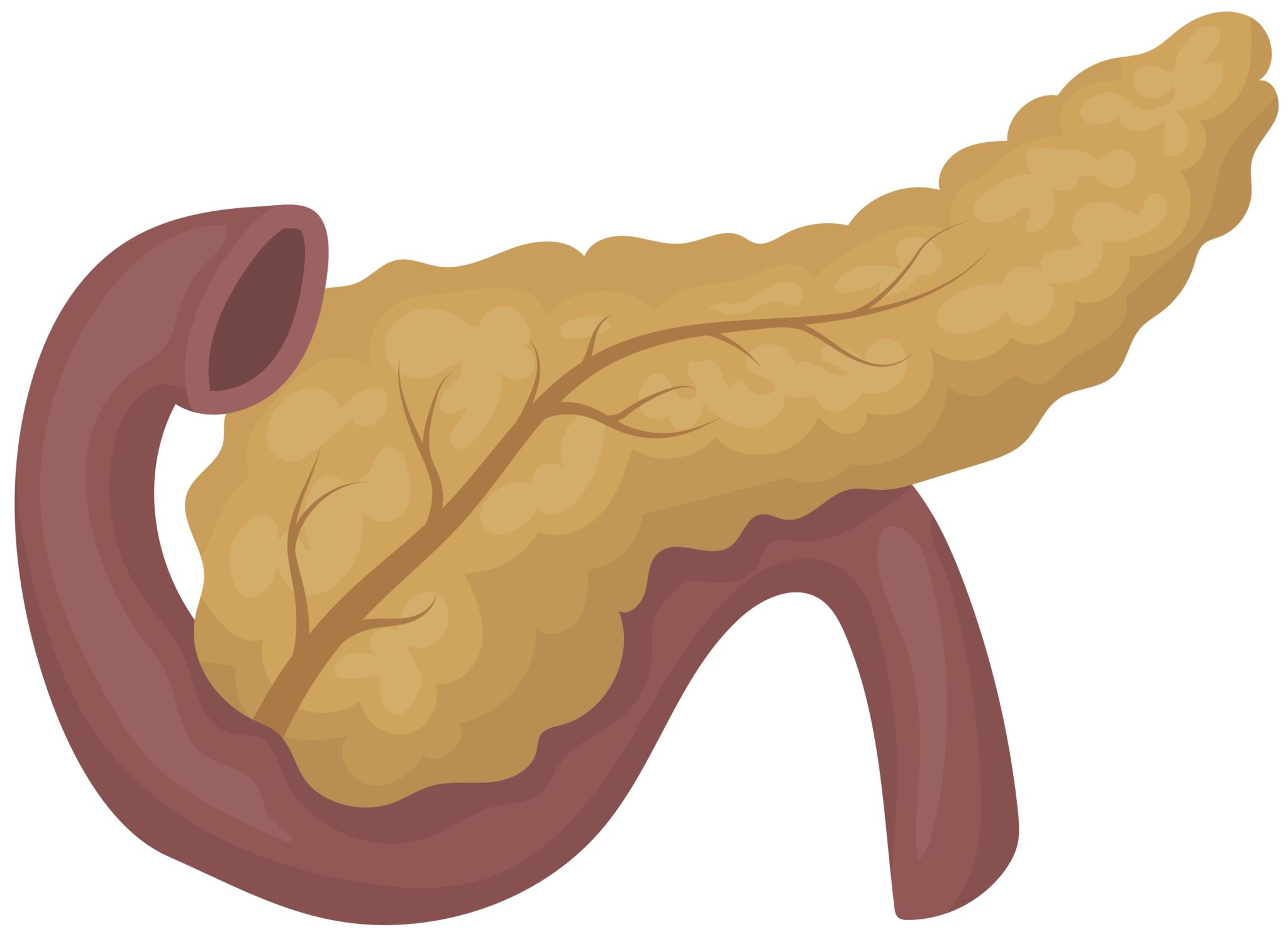 Kranky Panky 2020 - The month of the pancreas! - Guts UK