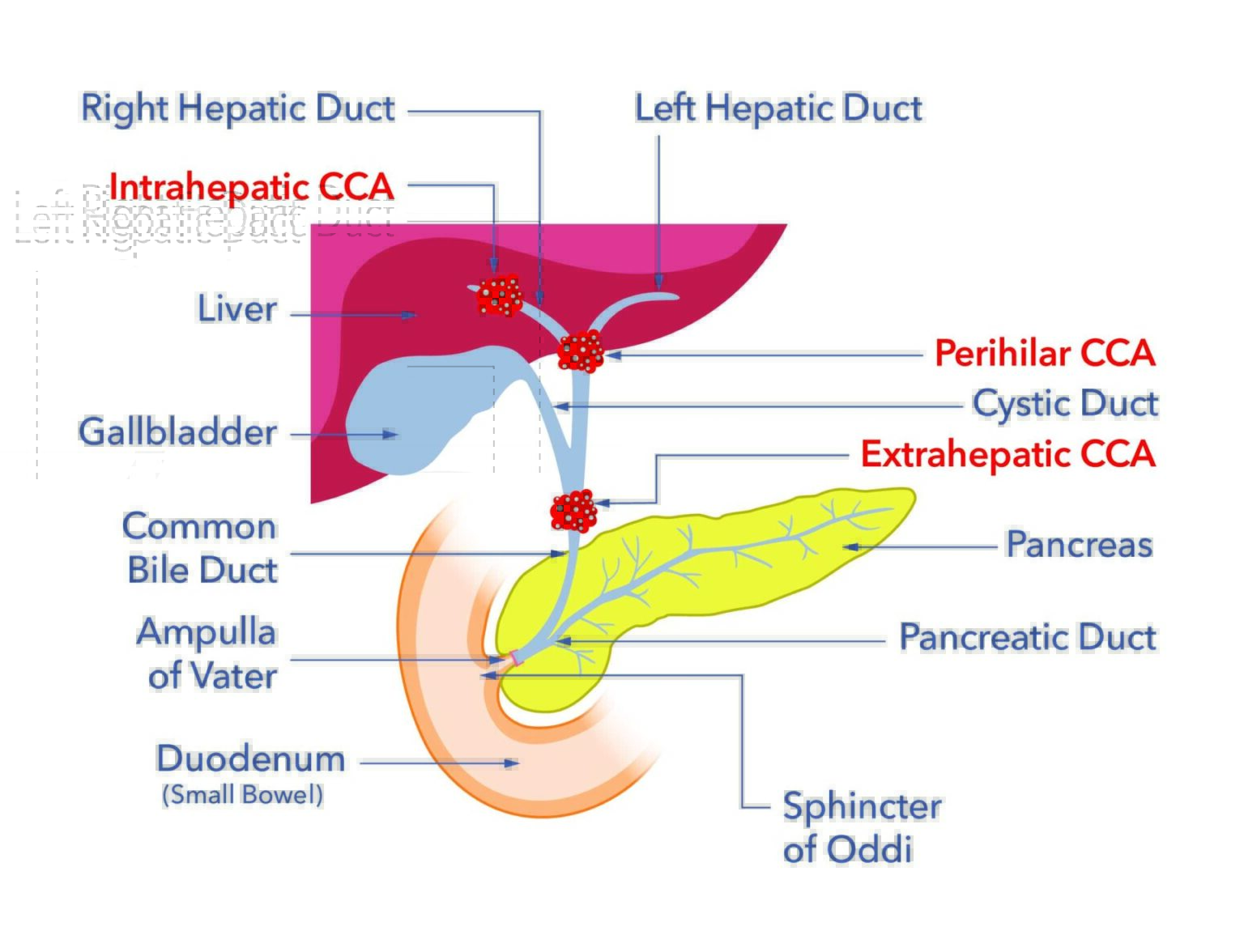 Bile Duct Cancer | Causes, Symptoms, Treatment & Support | Guts UK